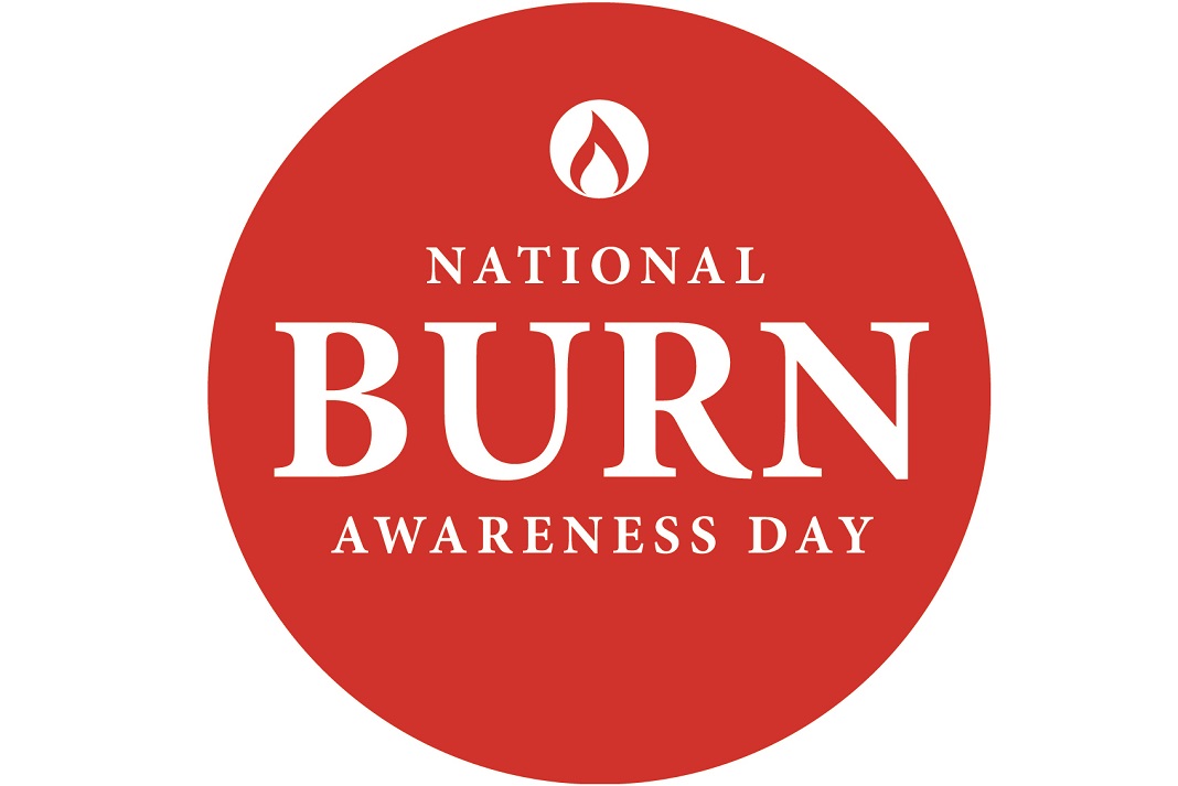BMA supports National Burn Awareness Day | Heating & Plumbing Monthly ...